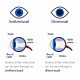 Dilated vs. Undilated Refraction: – Gupta Eye Care Bhiwadi